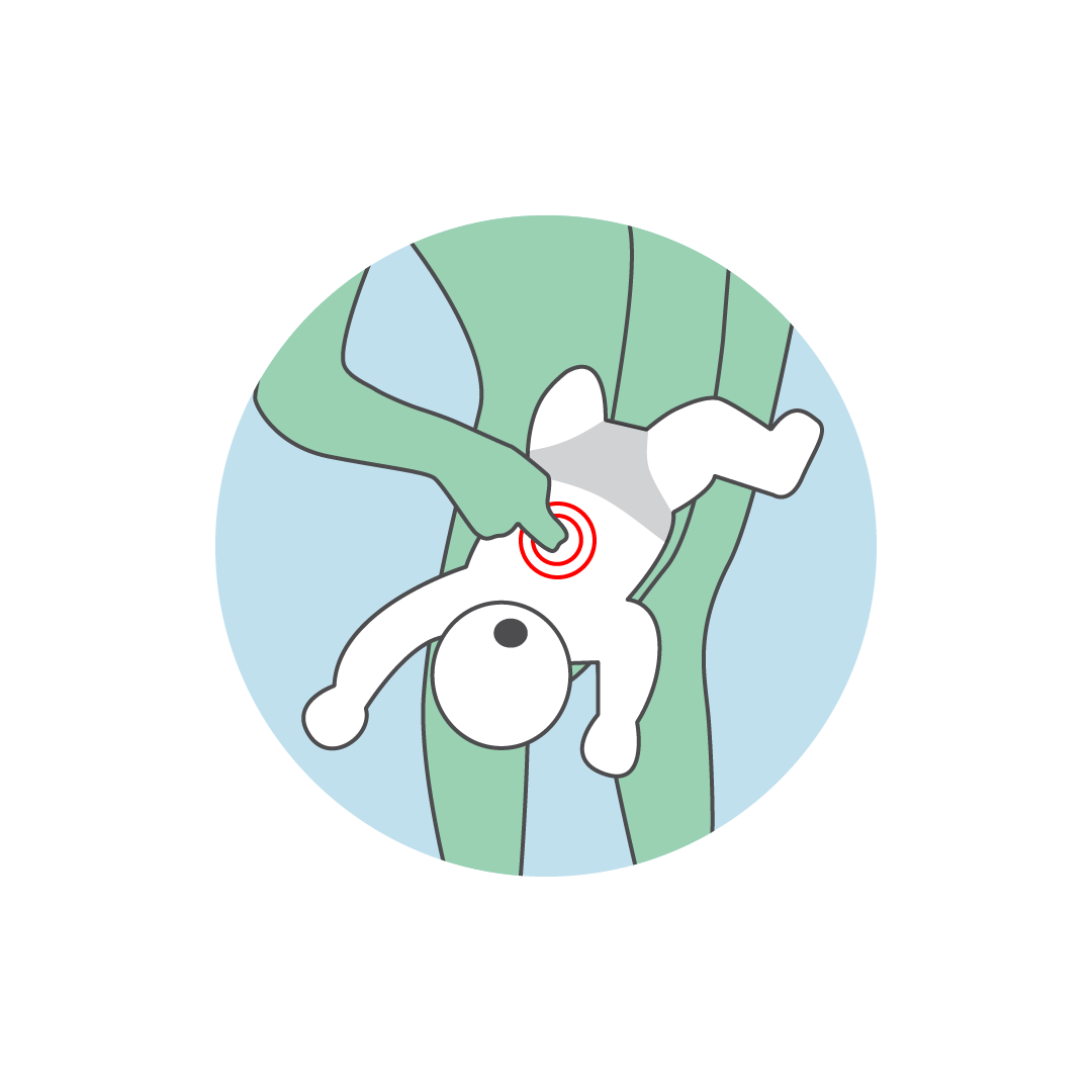Heimlich Maneuver on Choking Children | Carondelet Health Network